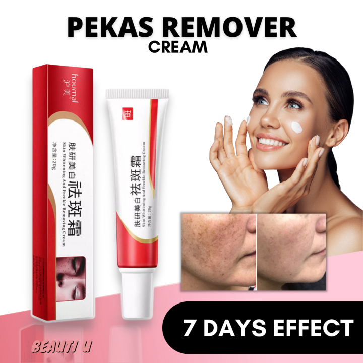PEKAS REMOVER EFFECTIVE Whitening Freckle Remover Cream Pekas Remover ...