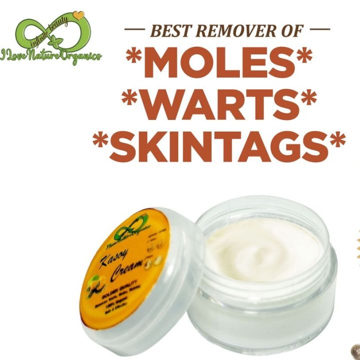 Kasoy Cream Warts Remover Original Mole Skintag Removal Organic | Lazada PH