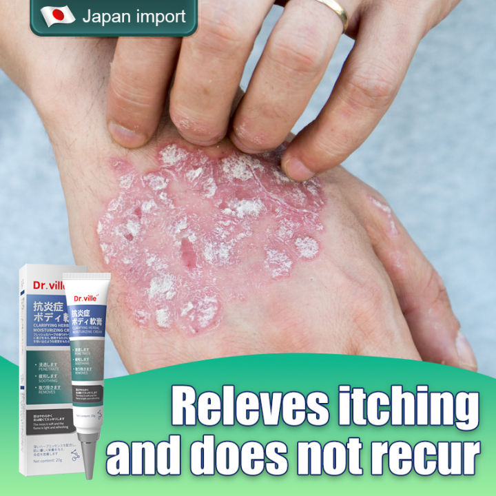 Japan Herbal Anti-Inflammatory Clearing Cream Skin Cream Stop Itchy Peeling Moss Cure Eczema ...