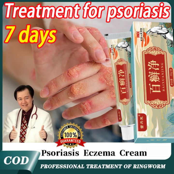 Psoriasis Cream Herbal Ointment Dermatitis Eczema Pruritu Vitiligo Skin ...
