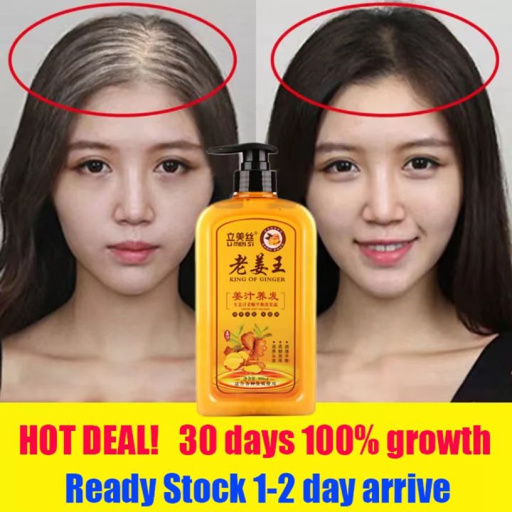 Original Ginger Shampoo Fast Powerful Hair Growth Liquid Anti Hair Loss ... Original Ginger Shampoo Fast Powerful Hair Growth Liquid Anti Hair Loss ...