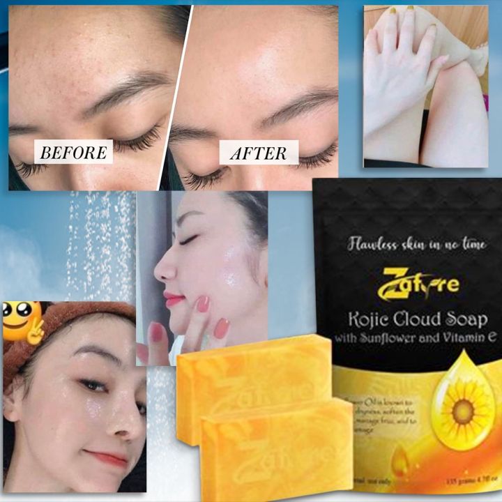 legit glass skin soap Zafyre kojic cloud soap with sunflower oil ...