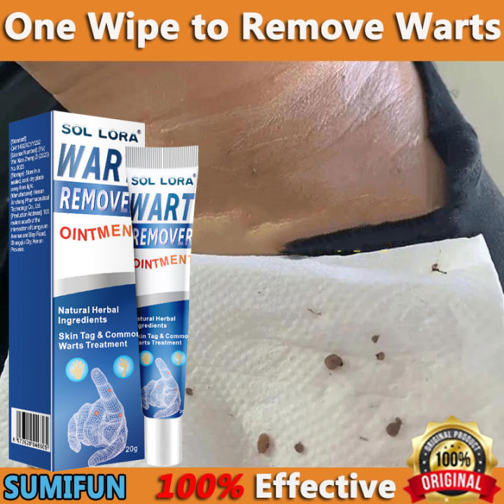 Original Painless Wart Remover Cream 20g Remover Wart Magic Ointment ...