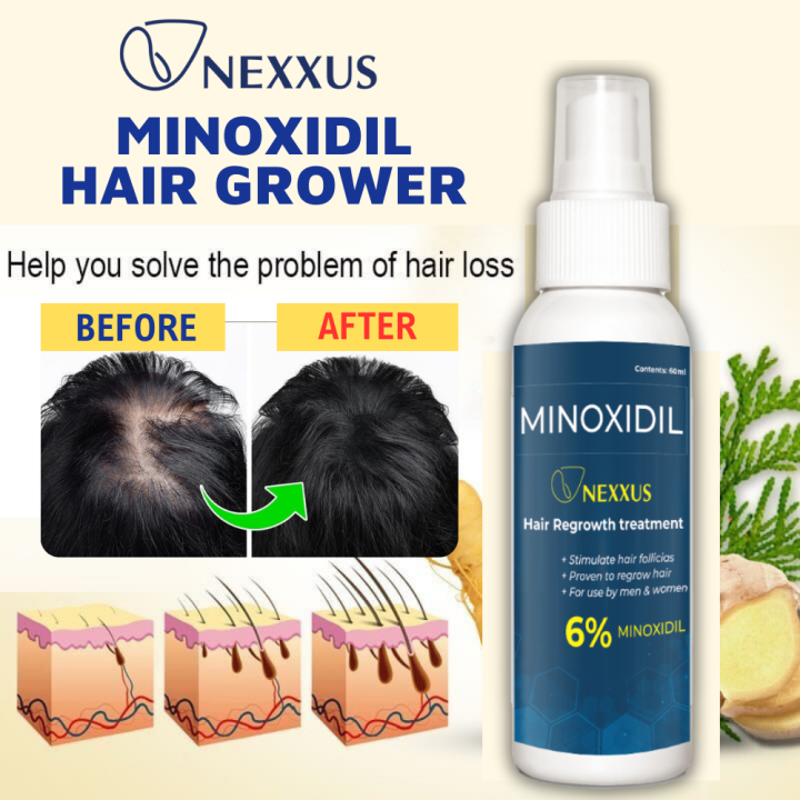 NEXXUS MINOXIDIL Hair Grower BEARD AND HAIR GROWTH SPRAY Nexxus ...