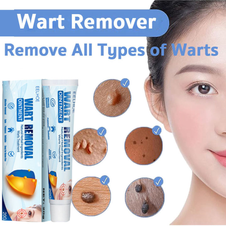 Warts Remover Original Cream Wart Removal Wart Treatment Skin Tags Mole ...