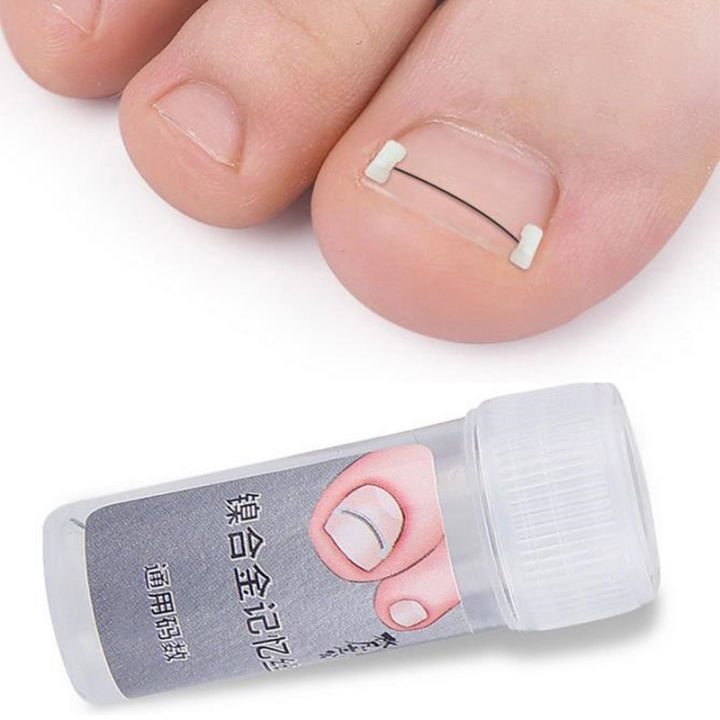 JDATAR Ingrown Toenail Tools Pedicure Recover Embed Toe Nail Treatment ...