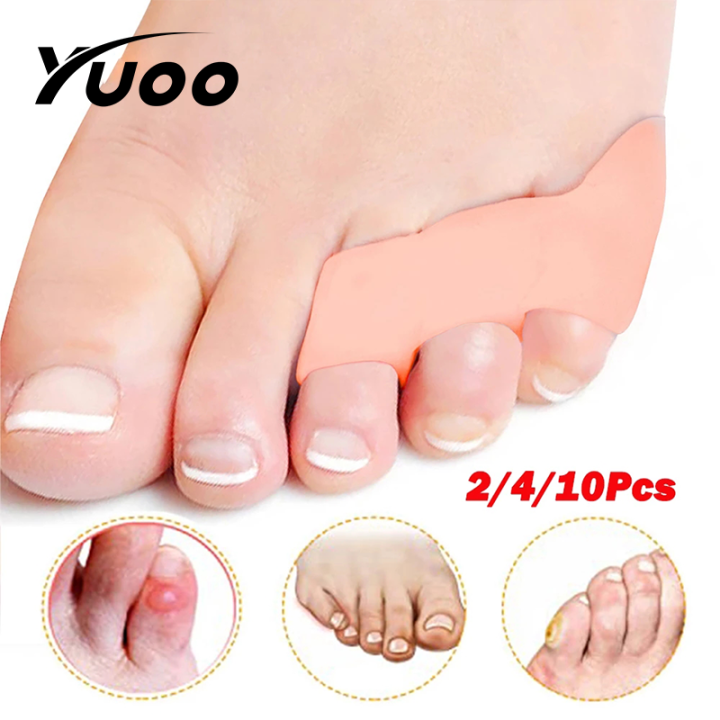 Yuoo อุปกรณ์แก้ไขเครื่องแยกตาปลานิ้วเท้าพิ้งกี้3หลุม2/4/10ชิ้น Relief ...