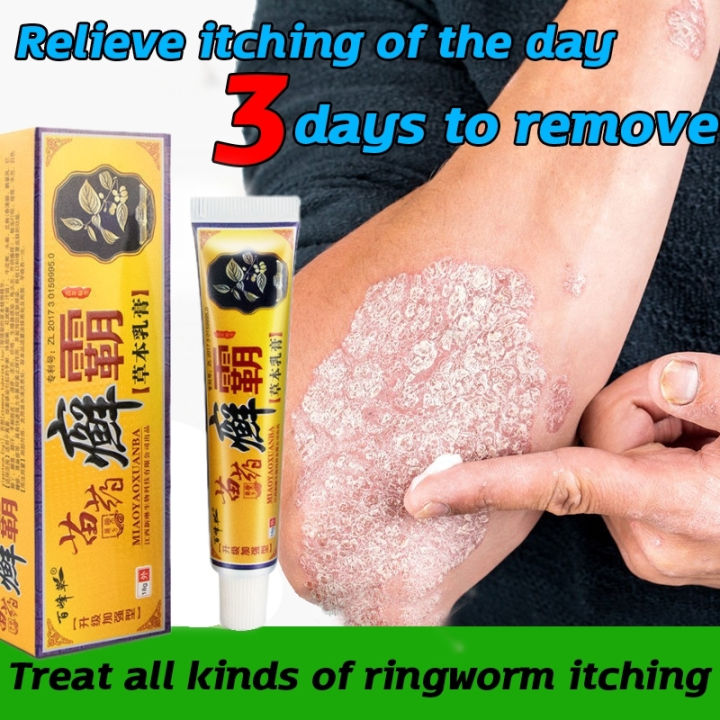 【Gamot Sa Kati Kati】Sumifun Eczema Treatment Cream Atoderma Cream ...