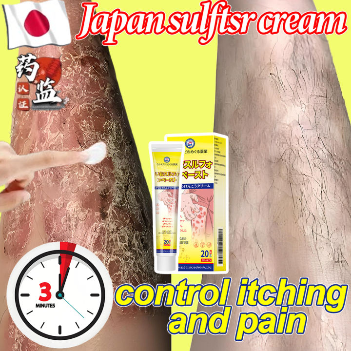 Japan Sulfur Eczema Antifungal Cream for Itchy Skin 20g Anti Itch Cream ...