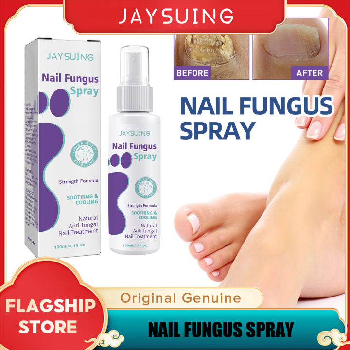 Jaysuing Nail Fungus Spray Treatments Essence Foot Care Serum Toe Nails ...