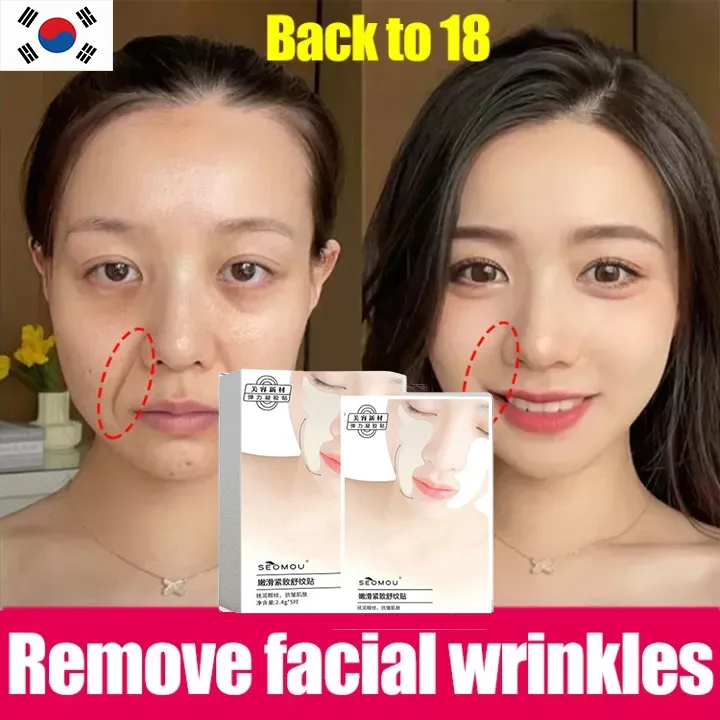 【Hot in Korea】Anti Aging Face Mask Lifting Nasolabial Fold Mask Wrinkle ...