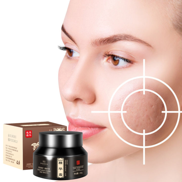 50g Scar Repair Cream Reduce Scar Marks Fade Scar Color Prevent Scar ...
