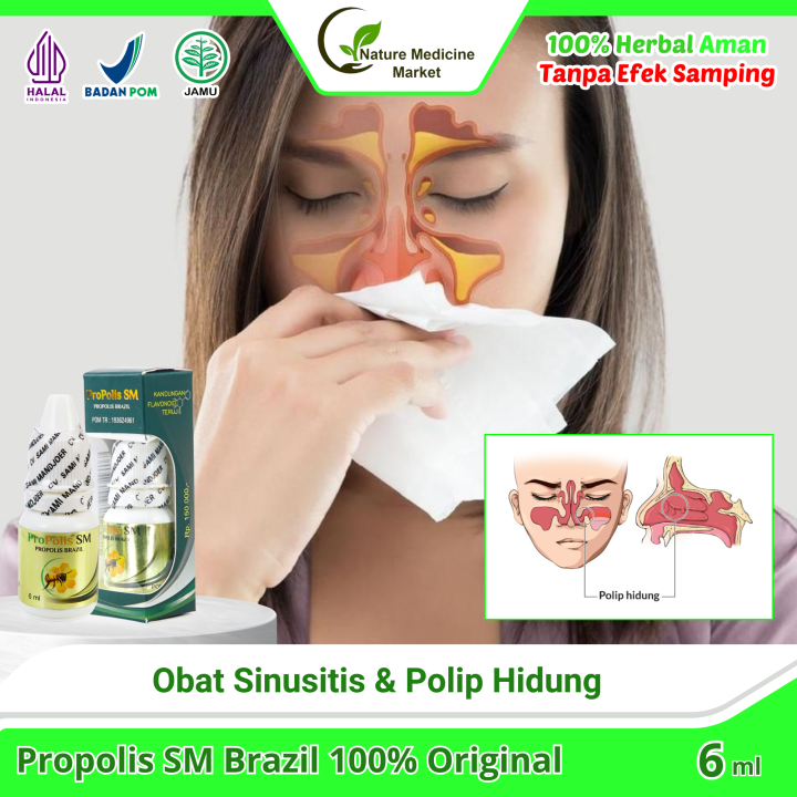 Obat Sinusitis Polip Hidung Rhinitis Alergi Sinus Hidung Bau Busuk ...