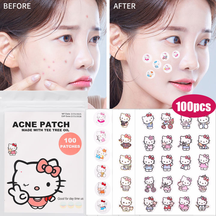 Dorisna 96/100pcs Acne Patches Sanrio Hello Kitty Shaped Acne Treatment ...