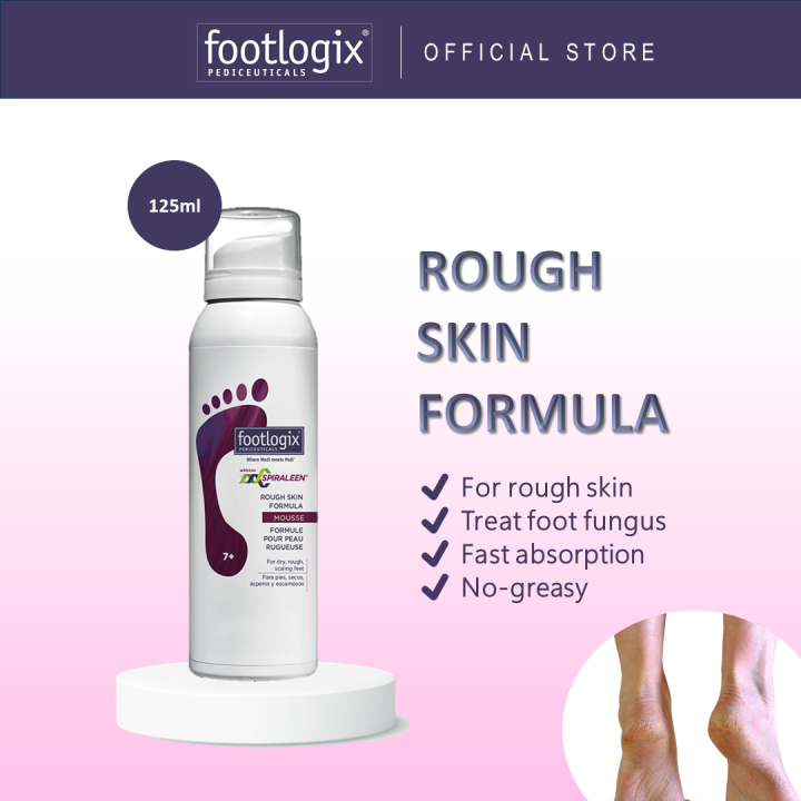 FOOTLOGIX Rough Skin Mousse Formula With Spiraleen #7+ (125ml) | Lazada