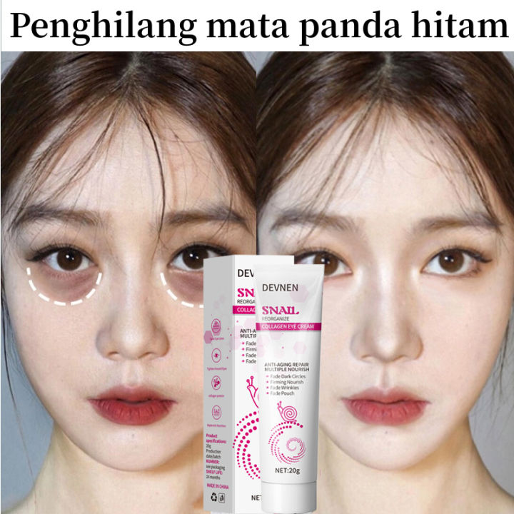 DEVNEN Snails Eye Cream for Dark Circle and Eyebag Eye Cream Serum / Collagen Anti Wrinkle and ...