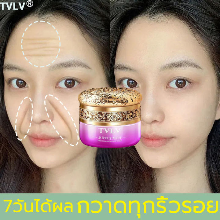 ลดริ้วรอยทั้งหมด TVLVครีมลดเลือนริ้วรอย เลือนริ้วรอย ริ้วรอยลำคอ ร่อง ...