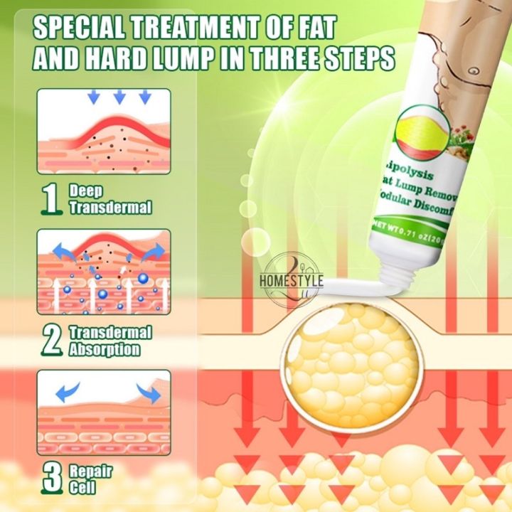 Original SOL LORA Lipoma Cream Removal of Subcutaneous Lipoma External ...