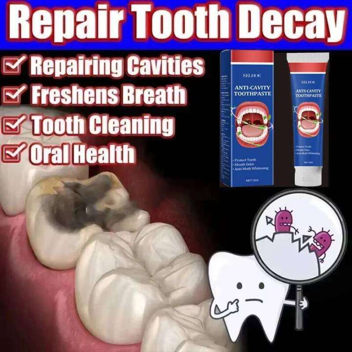 Toothpaste Whitening Cavities Caries Removal of Plaque Stains Decay ...