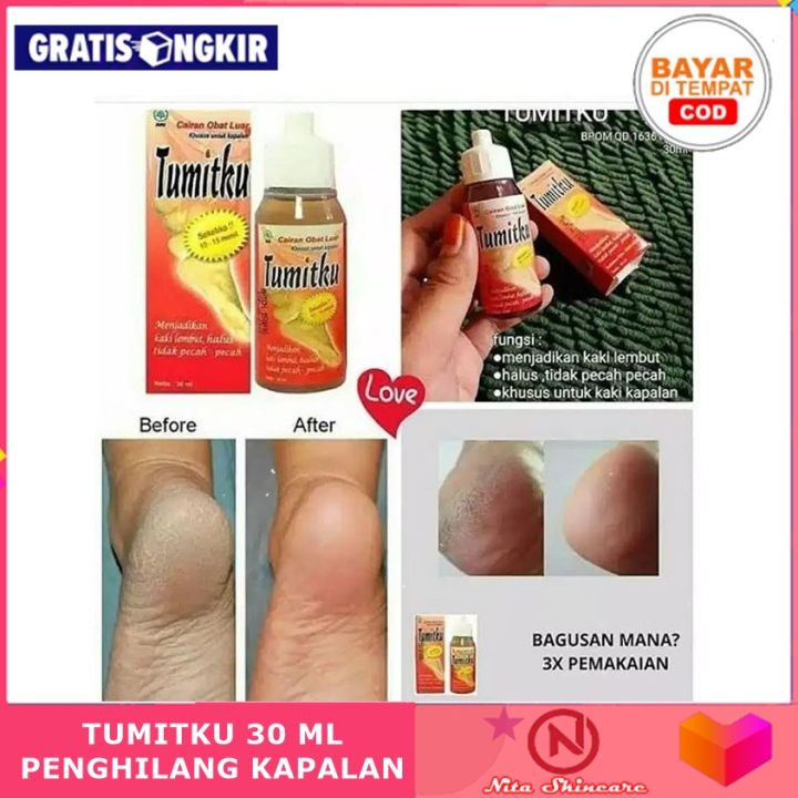 Nita Skincare - TUMITKU BPOM TUMITKU MENGATASI KAKI PECAH KAPALAN ...