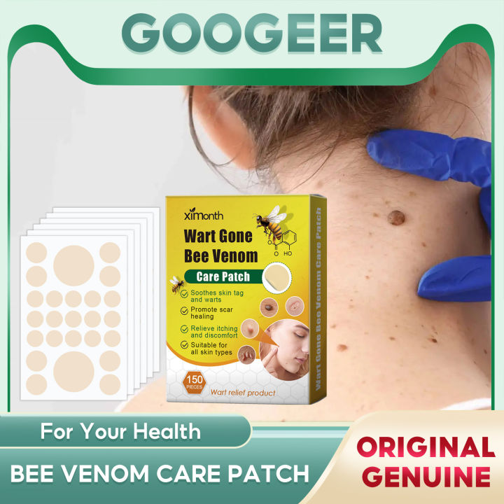 Ximonth Wart Gone Bee Venom Care Patch Sharp Warts Flat Warts Prickly ...