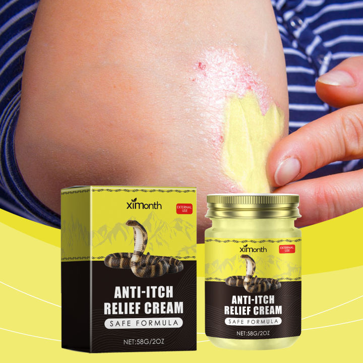 Ximonth Anti-Itch Relief Cream Antibacterial Anti-Itch Relief Skin Rash ...