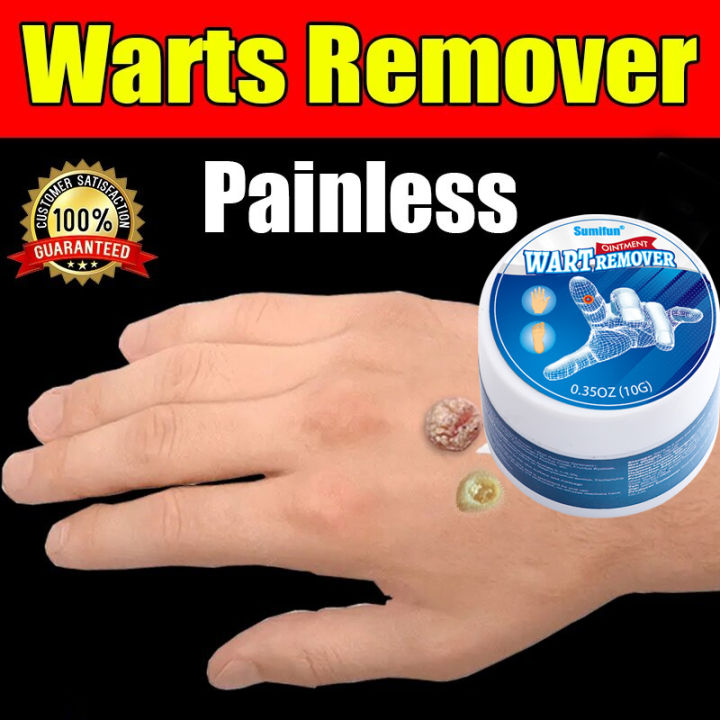 Warts Remover Original Cream 10g Warts Magic Remover Wartz Removal ...