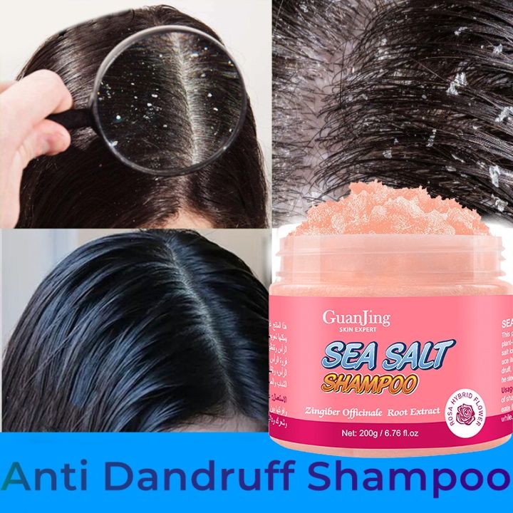 【COD】 200g Sea Salt Shampoo Itching Anti Dandruff Shampoo Psoriasis Treatment Scalp Scrub ...
