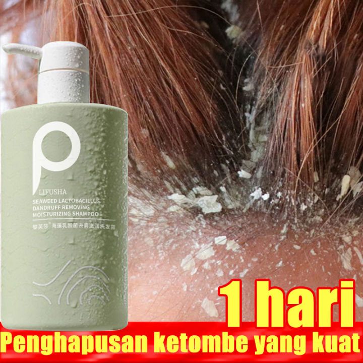 Sea Salt Anti-Dandruff Shampoo Anti-lice shampoo Oil Control Anti ...