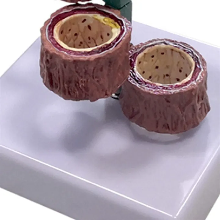 KITSUNE-Human Body 4-Piece Artery Model Anatomical Replica Model ...