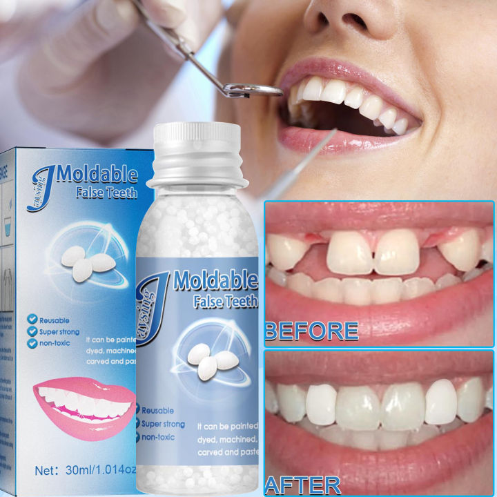 Temporary Tooth Repair 30g Kit Denture Adhesive Glue Decorative Denture ...