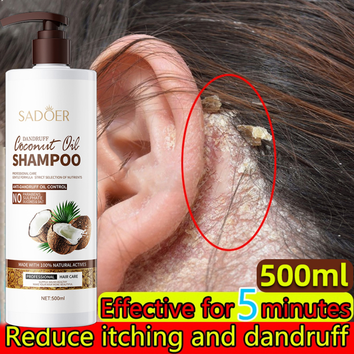500ml SADOER Coconut Oil Anti Dandruff Shampoo Moisturizing Refreshing Oil Control Shampoo ...