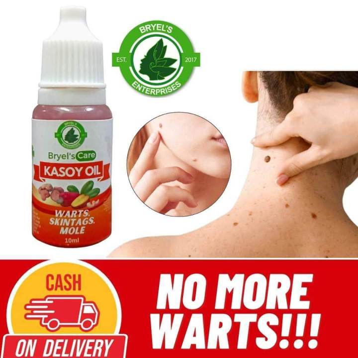 ⚡⭐10ml Organic Pure Kasoy Oil Warts Remover Skin Tags Remover, Mole ...
