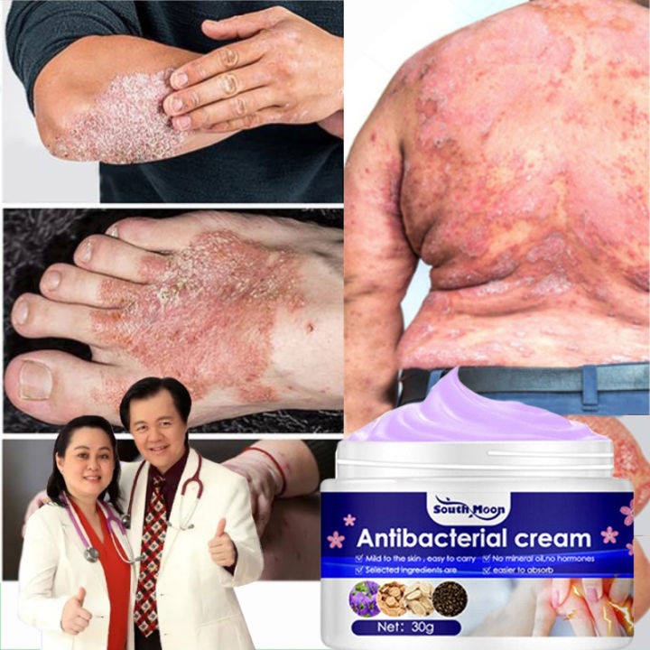 Antibacterial cream Ointment For Itchy Skin And Allergy Quick Relief ...