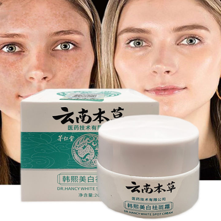 Original High Moisturizing Blemish Cream Sunburn, Freckle, Chloasma ...