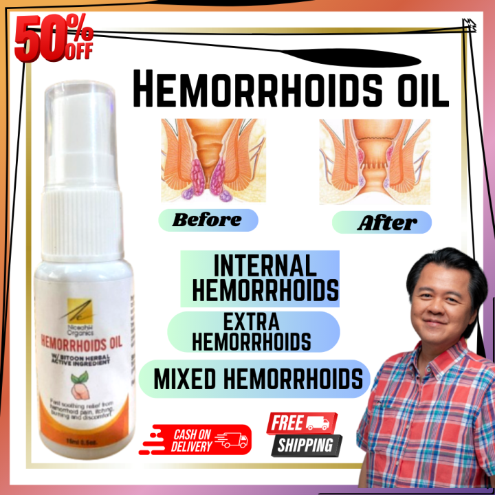 Original Hemorrhoids oil with bitoon herbal | Gamot sa almoranas No ...