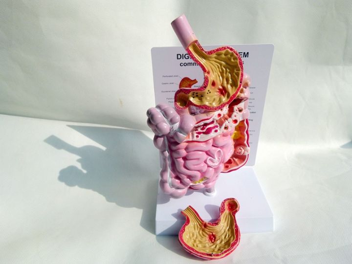 1/2 Life Size Human Digestive System Anatomical Model Colorectal ... 1/2 Life Size Human Digestive System Anatomical Model Colorectal ...