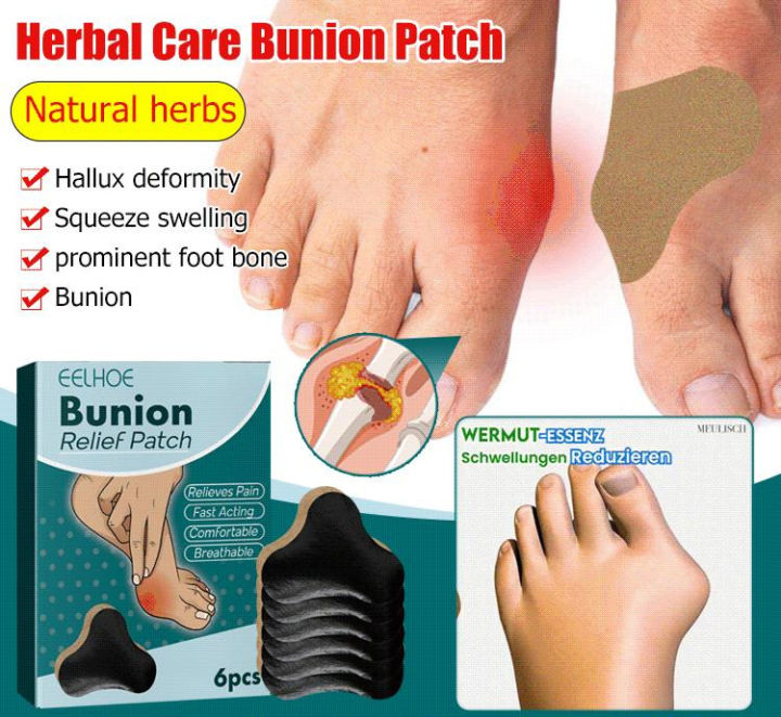 aomulei Anti Bursitis Patch For Correcting Swelling And Pain In The ...