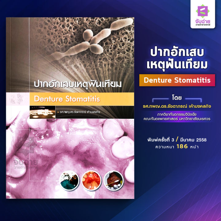 ปากอักเสบเหตุฟันเทียม (Denture stomatitis) | Lazada.co.th