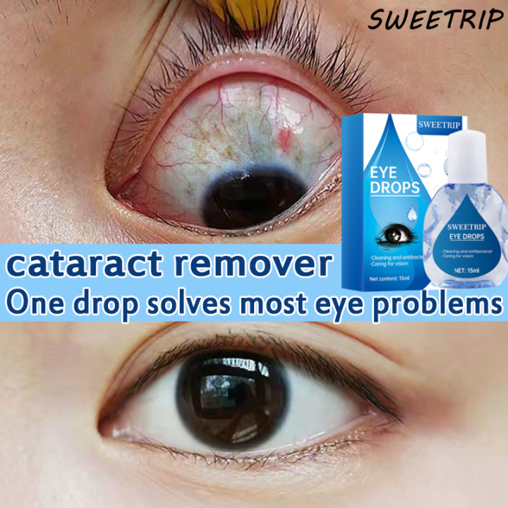 SWEETRIP Eye Drop Relieves Red Eyes Discomfort Blurred Vision Dry Itchy ...