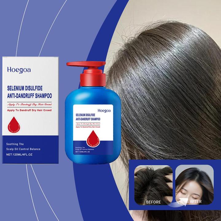 Selenium disulfide anti-dandruff shampoo oil-control refreshing and ...