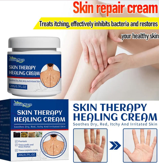 Skin Repair Cream Relief Itchy Itchy Redness Moss Topical Body Ointment ...