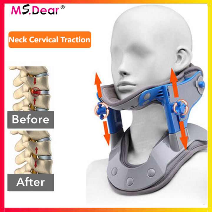 Hot Compress Neck Correction Electric Heating Collar Cervical Spine ...