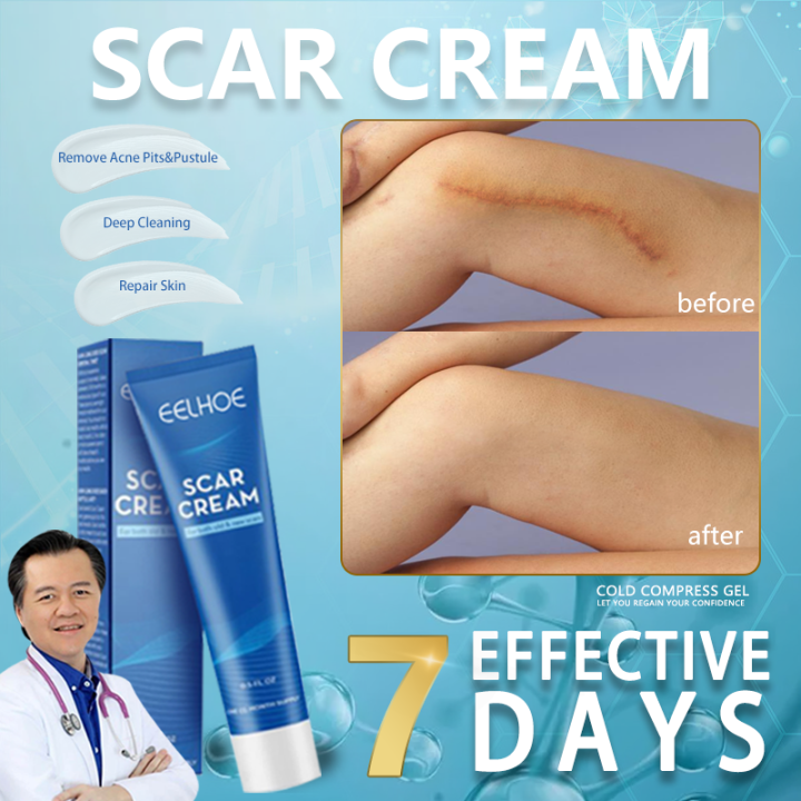 scars remover for old scars fix scar removal original scar remover fix ...