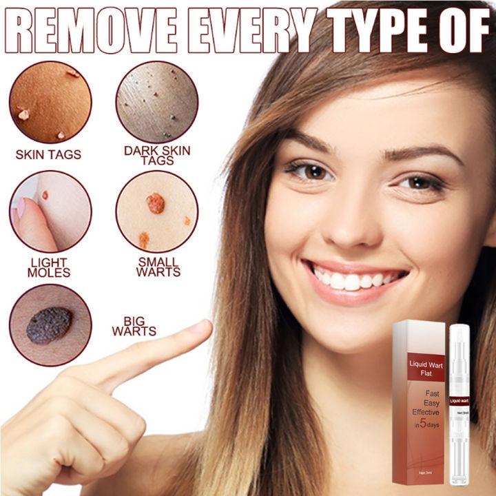 Eelhoe Liquid Wart Flat Remover Treatment Papillomas Removal Of Warts ...