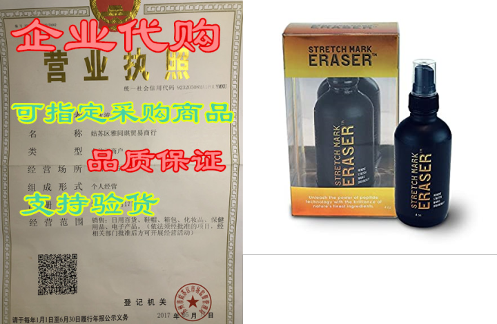 Stretch Mark Eraser - Removal & Treatment of Stretch | Lazada PH