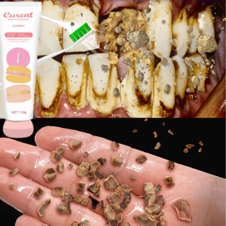 whitening toothpaste original ubat gigi pemutih oral care Remove tartar ...