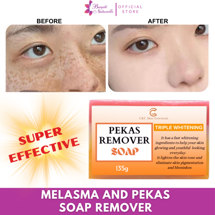 Melasma and Pekas Remover Soap: Your Key to Effective Original Care for ...