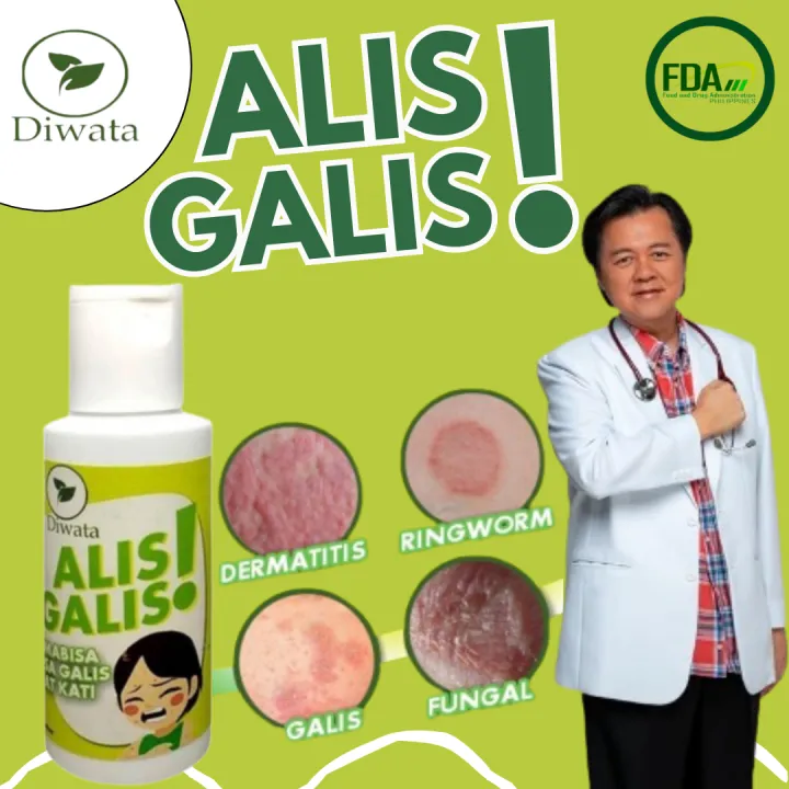 Alis Galis Fungal Kati Kati Ringworm Dermatitis 60ml Skin Itching ...