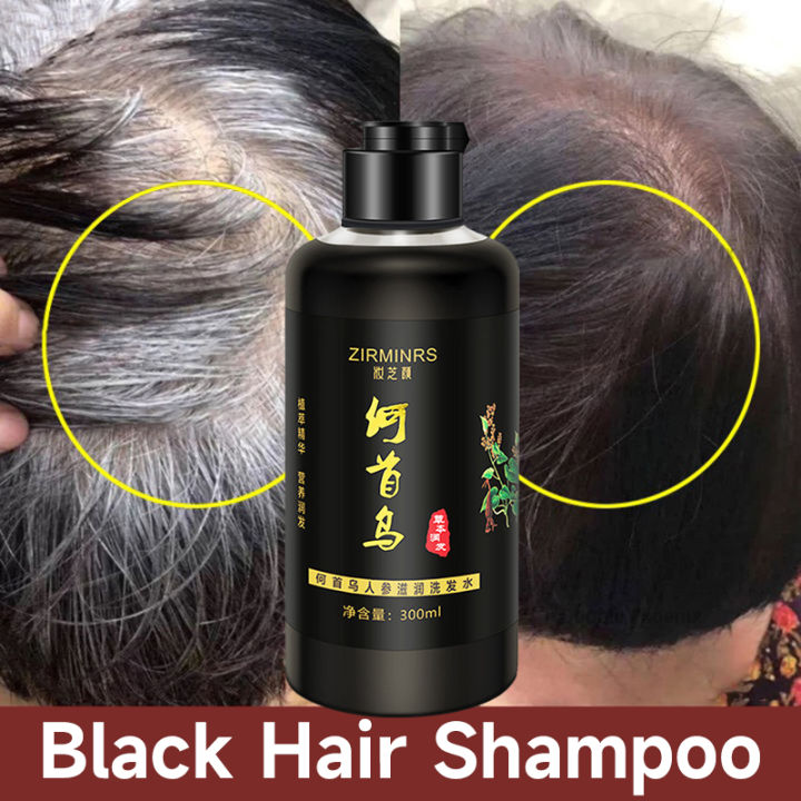 100% pure natural and harmless original natural hair loss shampoo Original Herbal Natural ...